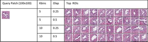 Accuracy Results Of 100 × 100 Query Patch—single Gland Download