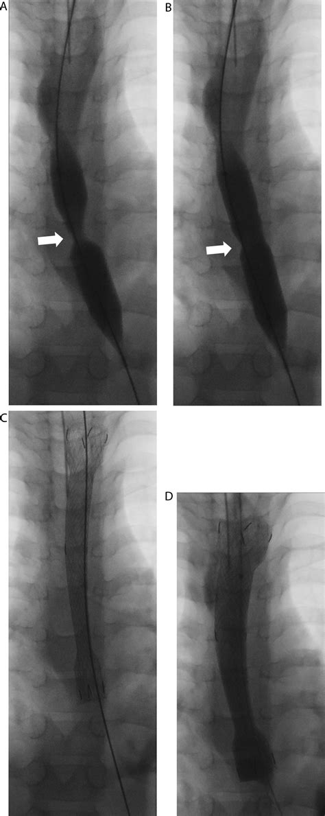 Non Vascular Interventional Radiology In The Paediatric Alimentary