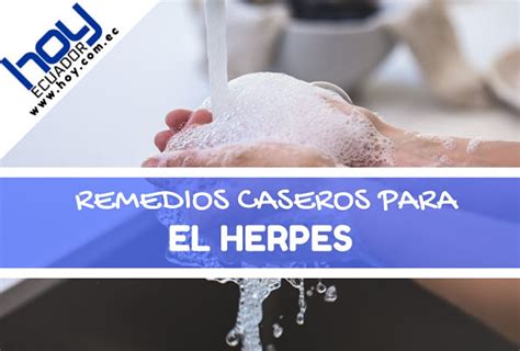 Remedios Caseros Para El Herpes
