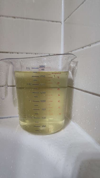 Have You Ever Measured Your Bladder Capacity By Peeing Into A Clear Measuring Vessel Page