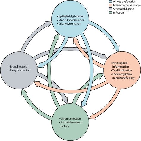 Bronchiectasis Medicine