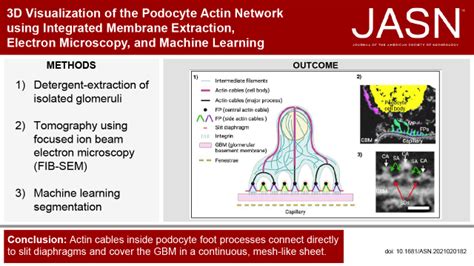 Three Dimensional Visualization Of The Podocyte Actin Network Using