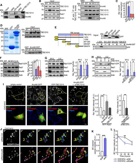 Anxa6 Interacts With Tbc1d15 A Mouse Liver Homogenates Were