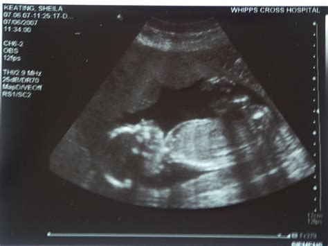 21 неделя беременности фото живота УЗИ и вес плода боли и выделения на 21 неделе