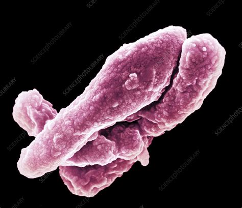 Bacillus And Clostridium Sem Stock Image C058 4759 Science Photo Library