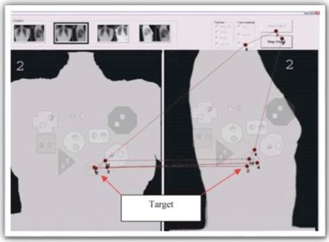 Simulated Radiology Gui Evaluation With Eye Tracking Moise Et Al 2006