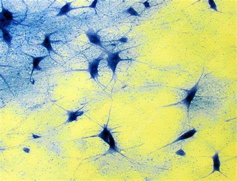 Nerve Cells Light Micrograph Stock Image C056 9812 Science Photo Library