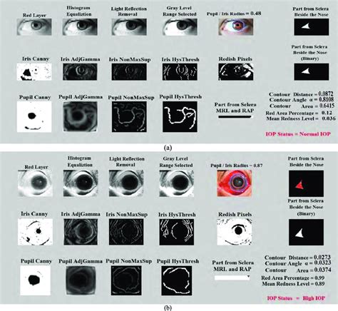 Sample Image Segmentation Feature Extraction And Classification For