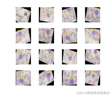 基于yolov2深度学习网络的血细胞检测算法matlab仿真 yolo微出血点 csdn博客