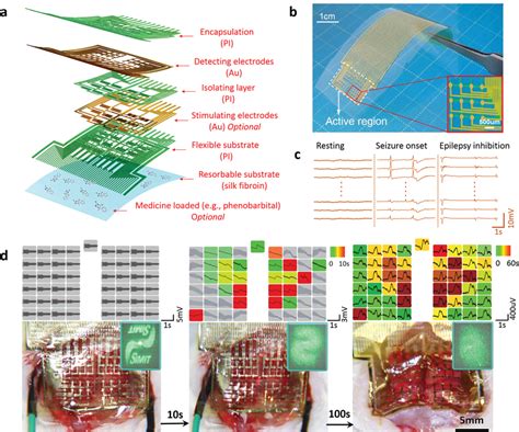 Schematic Of Device Configuration And Conformal Mounting Working On Rat