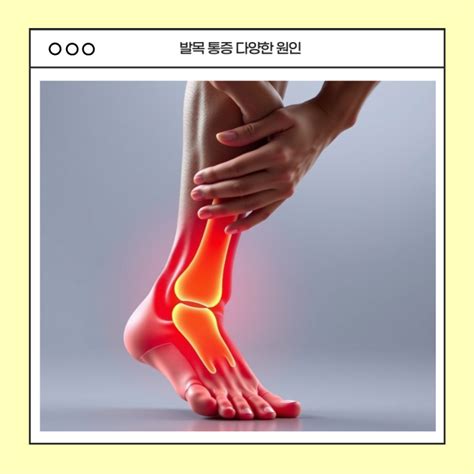 발목 아플때 발목염좌 발목염증 붓기 찜질 통증 원인 네이버 블로그
