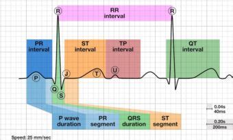 PR Interval LITFL ECG Library Basics