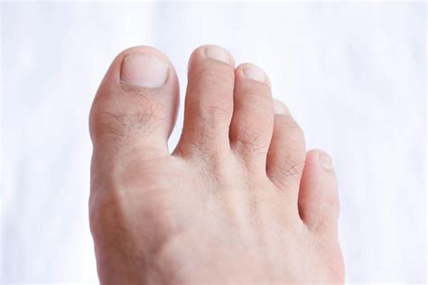 Big Toe Inflammation