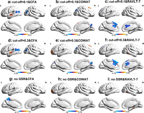 correlation analysis between voxel based weighted degree and