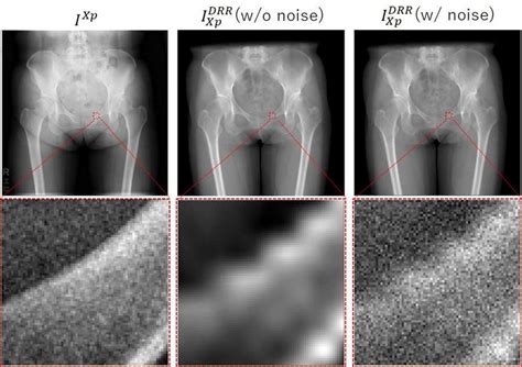 Comparison Between Real And Simulated X Ray Images From Left To Right Download Scientific