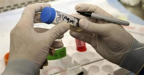 Quest Faces Next Ravgen Dna Testing Patent Trial After 272 Mln Labcorp