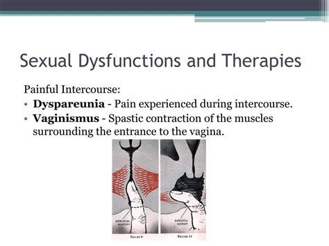 Ppt Sexual Dysfunctions And Therapies A Comprehensive Guide Powerpoint Presentation Id