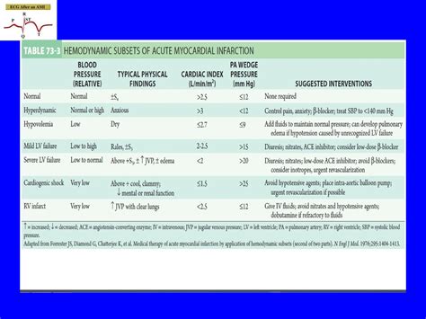 St Segment Elevation Acute Myocardial Infarction And Complications Of Myocardial Infarction