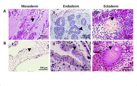 Detection Of The Three Germ Layer Specific Tissue Types In Teratoma Download Scientific Diagram