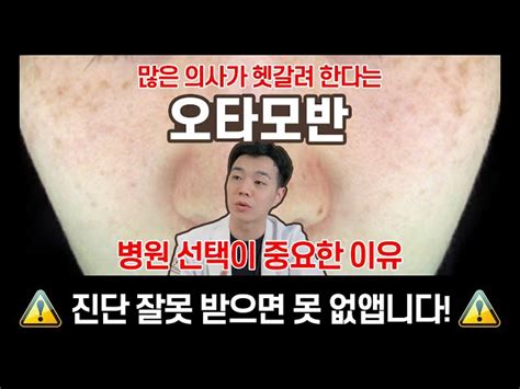 👀오타모반 치료 병원 선택은 정말 신중히 하셔야 합니다