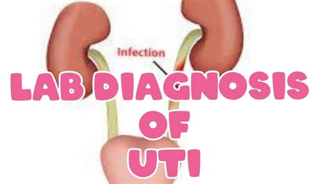 What Laboratory Test For Uti At Sybil Downing Blog
