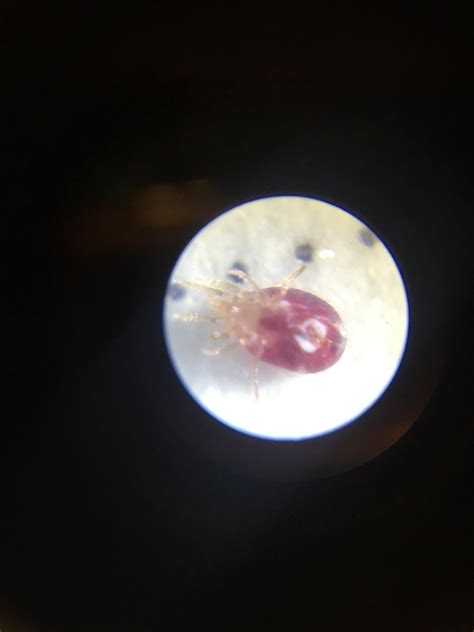 This Bug Bit Me In My Belly Button What Is It Picture Taken With Pocket Microscope Its 05