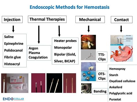 Treating Upper Gastrointestinal Bleeding An Update On Endoscopic