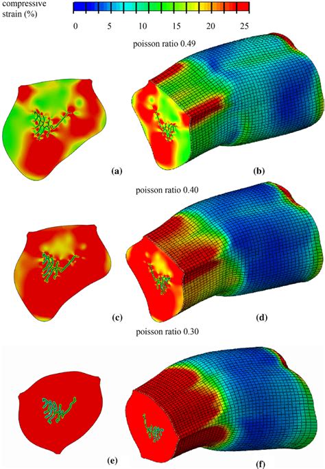 Compressive Strain As The Minimum Principal Strain Fields Reported On Download Scientific