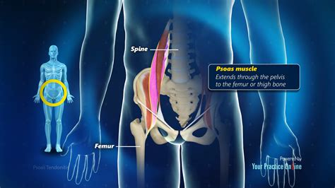 Hip Flexor Tendonitis Psoas Tendonitis Best Treatment Options