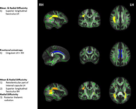 significant sex associations with white matter microstructure are shown