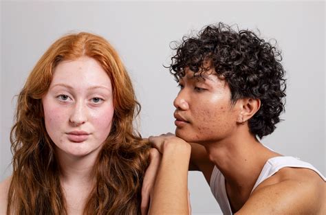 What Does Acne Positivity Mean Lets Normalize Acne And Pimples