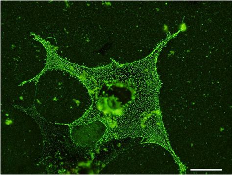 Figure 1 From Iga Pemphigus Semantic Scholar
