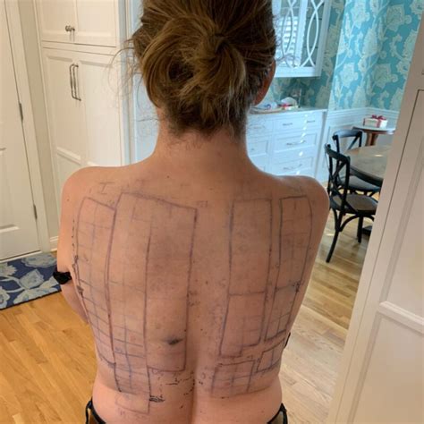 What Is A Patch Test The Allergy Life