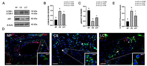 Wb And If Analysis Of Lc3b And P62 In Np Cs And Lct Testicular Tissue
