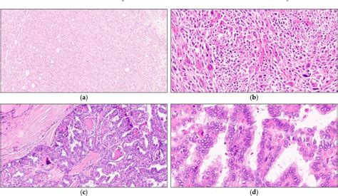 Figure 1 From Deep Learning Prediction Of Tert Promoter Mutation Status