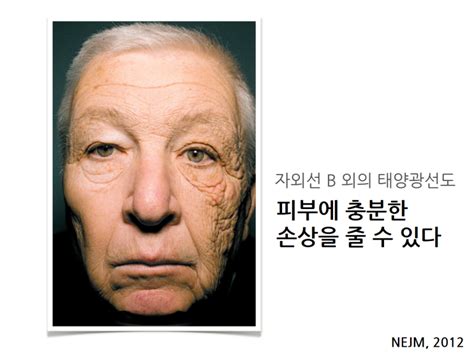 자외선차단제 올바른 이용법 Spf Pa 차단지수 이해하기 2부 By 아는의사 네이버 블로그