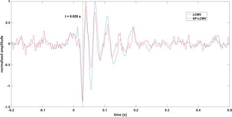 Time Course Of The Localized Sources With Maximum Pseudo Power The
