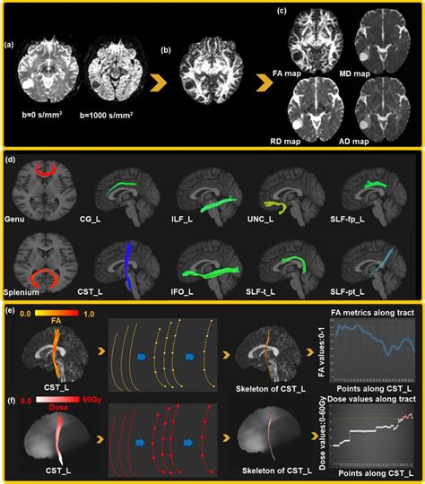 Workflow Of The Representative Steps Necessary For The Along Tract Download Scientific Diagram