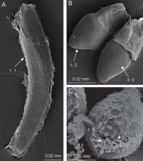 Transmission Electron Microscopy Of Eggs A Strongygaster
