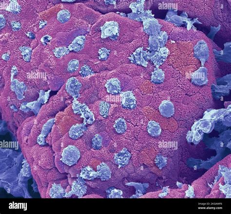 Colon Colour Scanning Electron Micrograph Sem Of The Wall Of The Human Large Intestine Colon