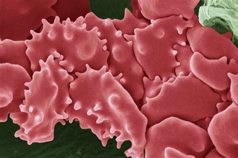 39 Facts About Tonicity