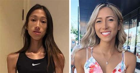 Sarah Rav Doctor Reveals How She Battled Horrific Eating Disorder
