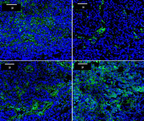 Concentration Of A Mouse Vegf And B Human Vegf In Tumor Tissue In