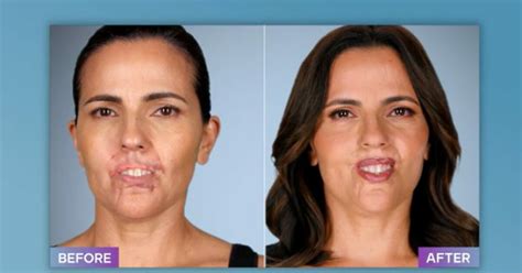 Plastic Surgeon Who Fixes Botched Operations Goes Viral After