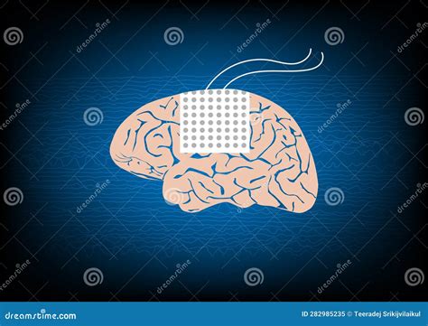 Brain Mapping Surgery Stock Illustrations 18 Brain Mapping Surgery Stock Illustrations