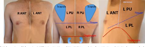 Figure 1 From Automatic Deep Learning Based Pleural Effusion Classification In Lung Ultrasound