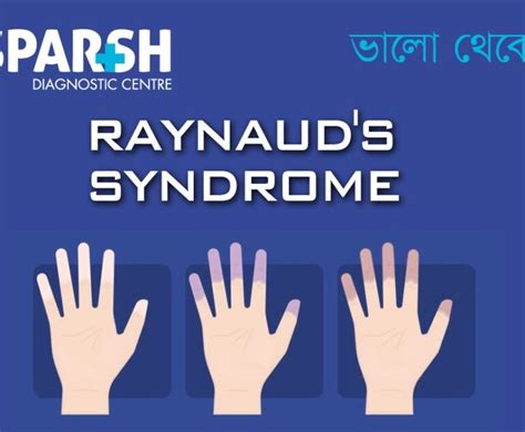 Low Libido Sparsh Diagnostic Center