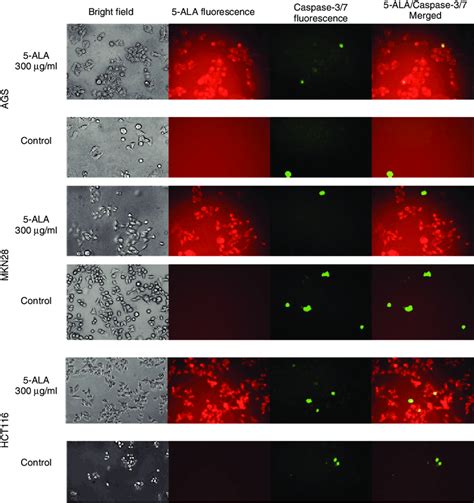 Assessment Of Early Apoptosis In Cells Early Apoptosis In Cell