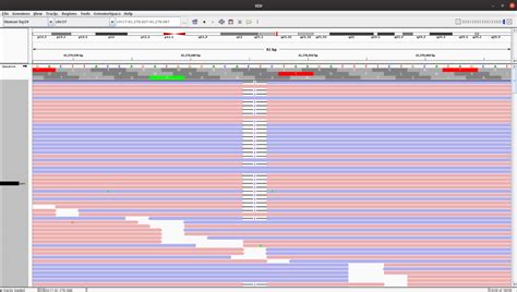 Germline Brca1 Mutation Insquamous Cell Carcinoma Of Oesophagus Driver