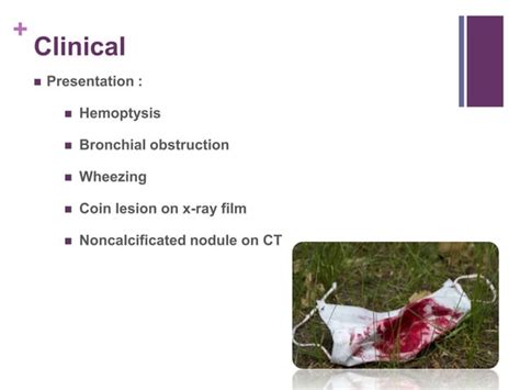 Lung Cancer Pathology And Clinical Pptx